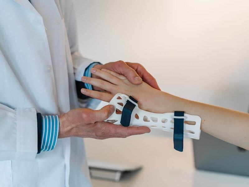 Frattura del polso: come riconoscerla e trattarla - FisioOneCare ...